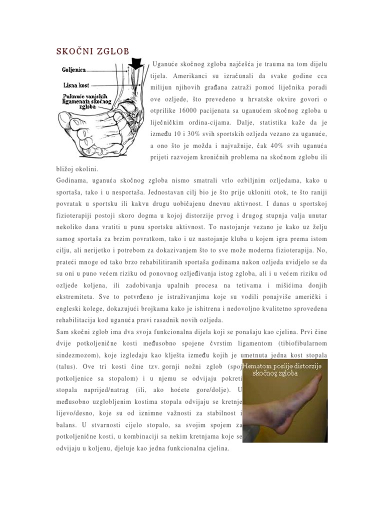 Distorzija | PDF