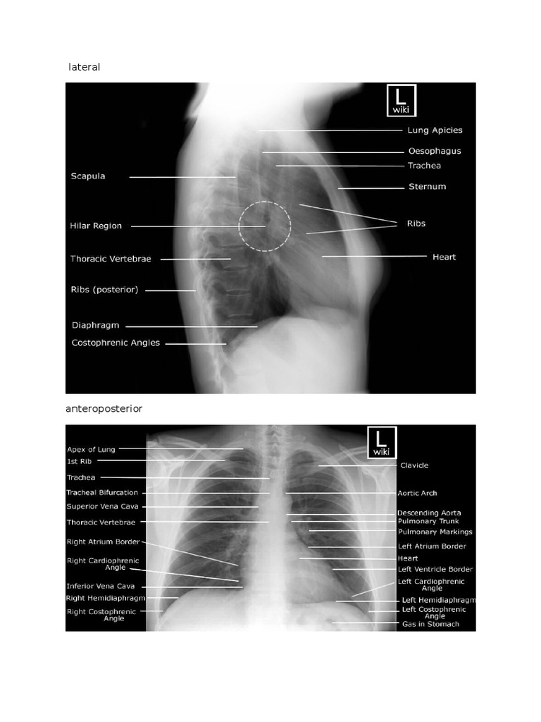 Posisi Rontgen | PDF
