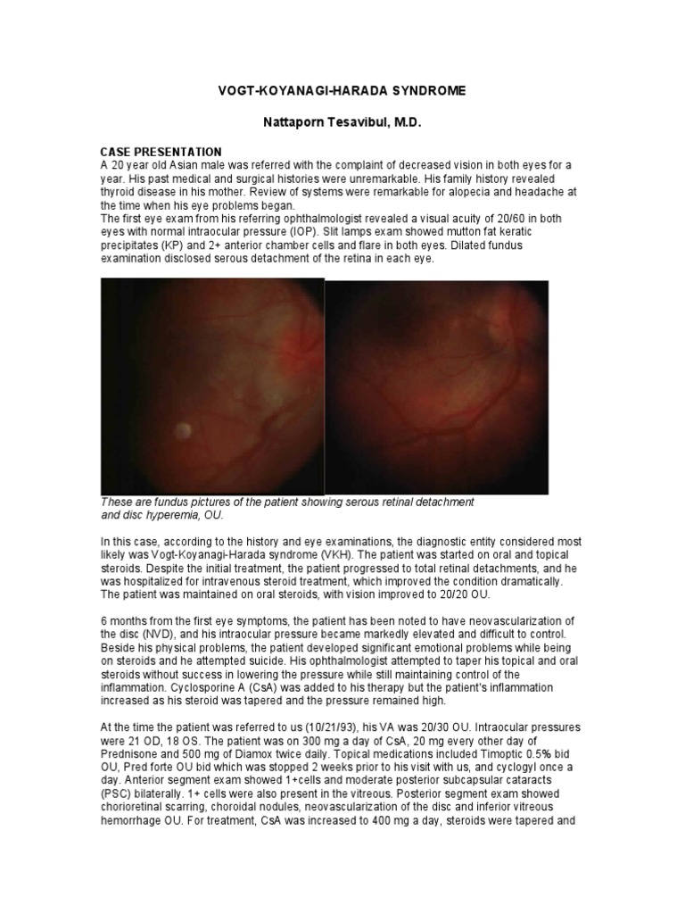 Vogt Koyanagi Harada Syndrome | Immunology | Ophthalmology