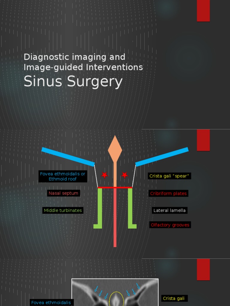 Diagnostic Imaging and Image-Guided Interventions Sinus Surgery | PDF ...