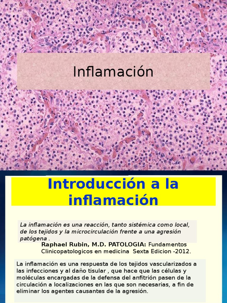 Expo Inflamacion PowerPoint | Inflamación | Sistema inmune