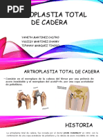 Protesis de Thompson Espanol SCECLE | PDF | Cirugía | Medicina CLINICA