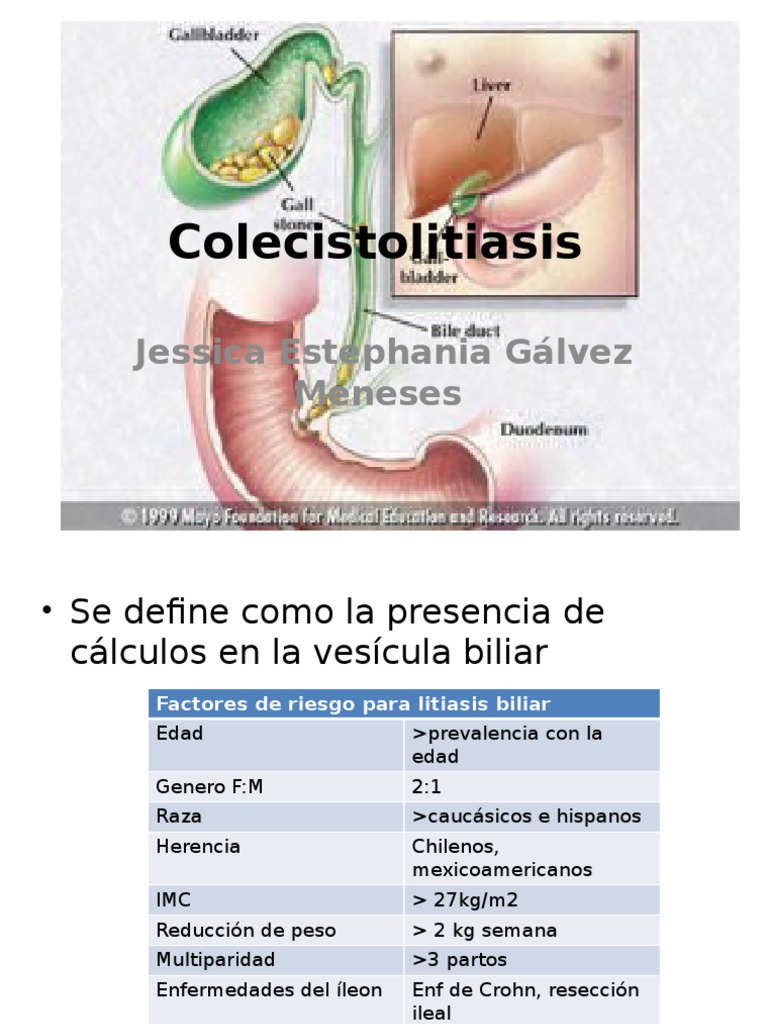 Colecistolitiasis | Bilis | Colesterol