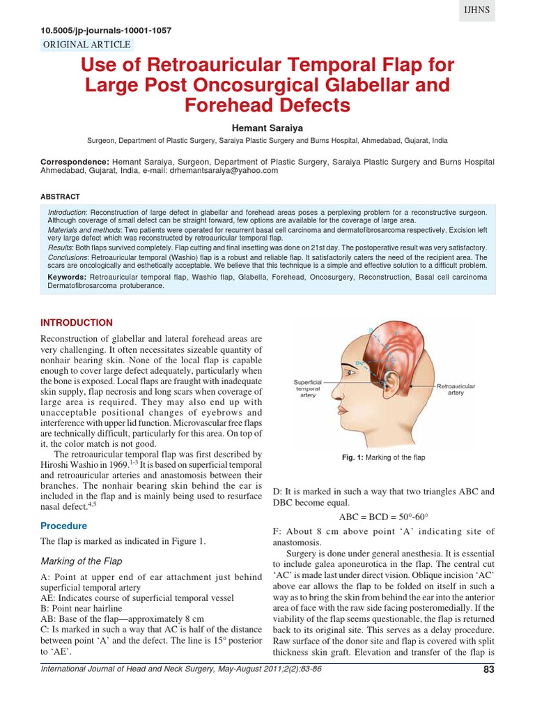 Use of Retroauricular Temporal Flap For Large Post Oncosurgical ...