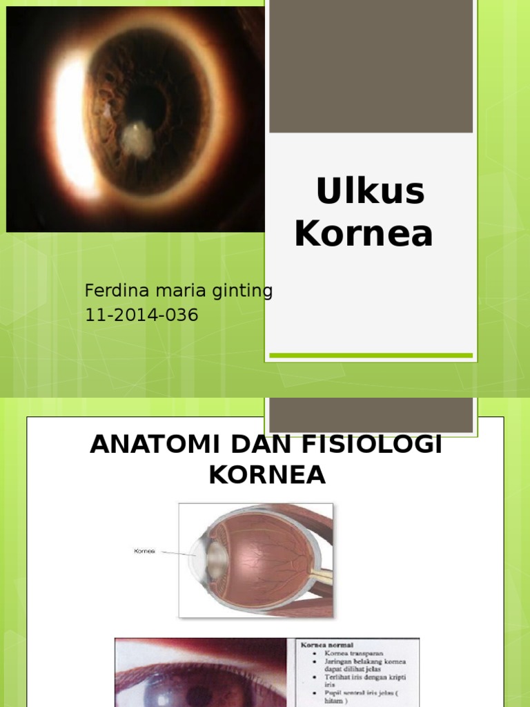 Penyuluhan Ulkus Kornea | PDF