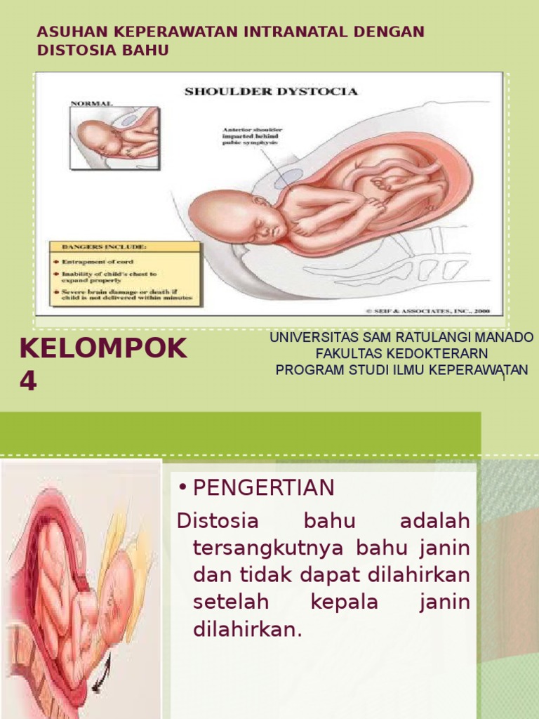 Distosia Bahu | PDF | Sains & Matematika