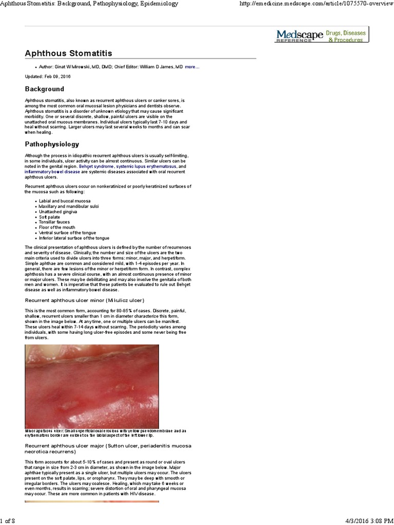 Aphthous Stomatitis - Background, Pathophysiology, Epidemiology | PDF ...