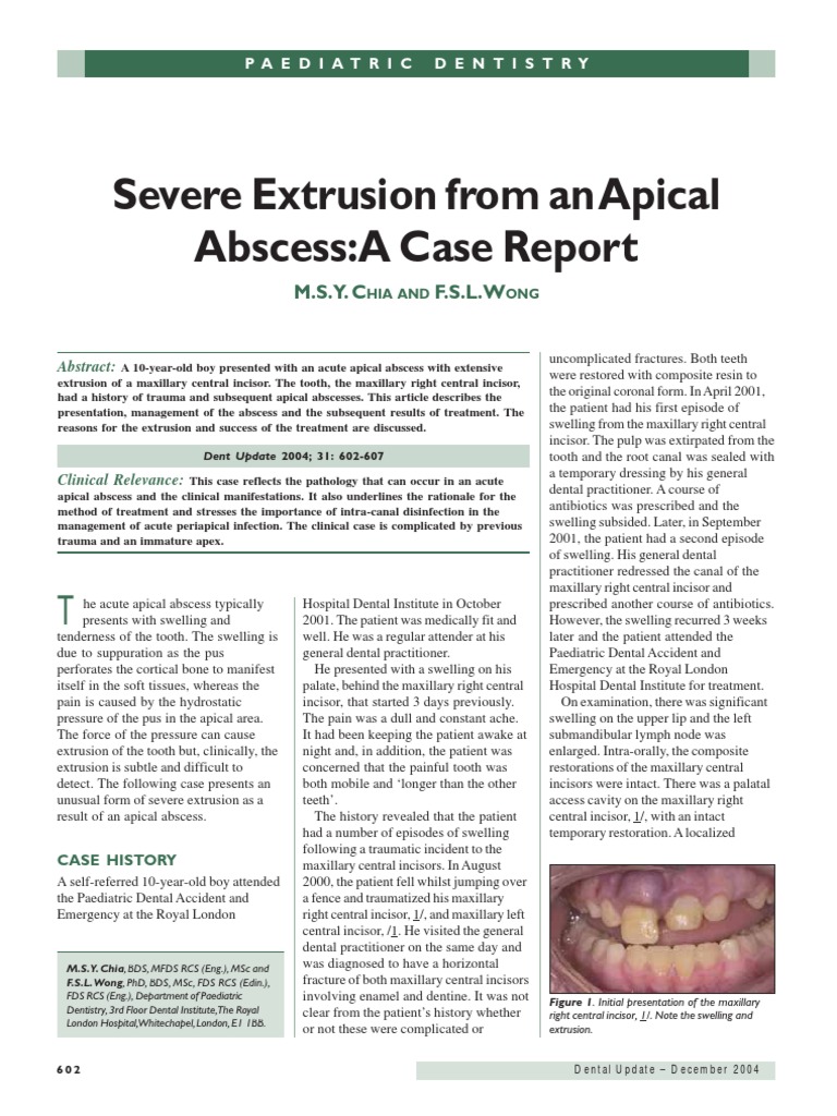 Acute Apical Periodontitis