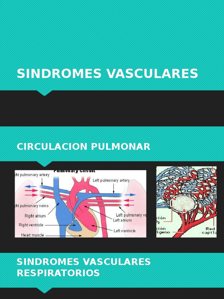 Sindromes Vasculares | PDF
