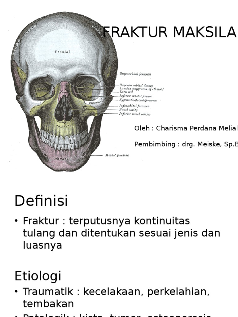FRAKTUR MAKSILA