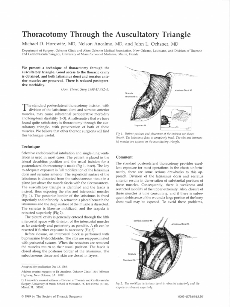 Thoracotomy Through The Auscultatory Triangle - Ann Thorac Surg.1989 ...