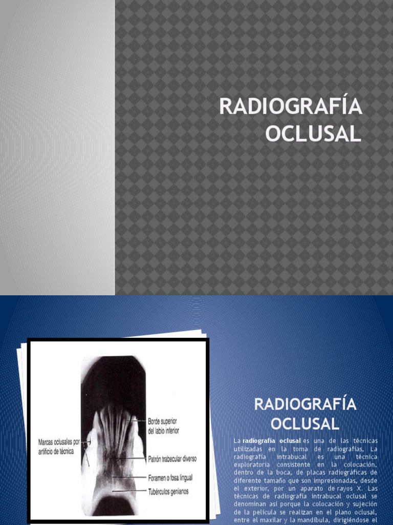 Rx Oclusal | Radiografía | Diente humano