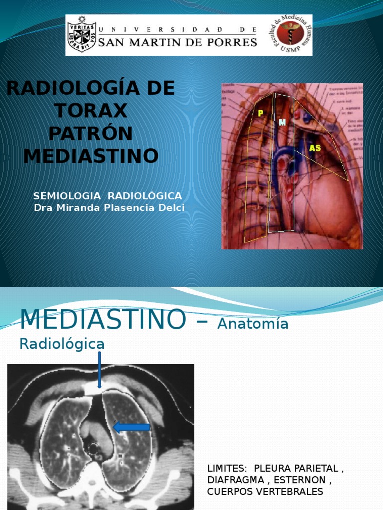 Diagnóstico Por Imagen - Mediastino | PDF | Sistema respiratorio | Tórax (anatomía humana)