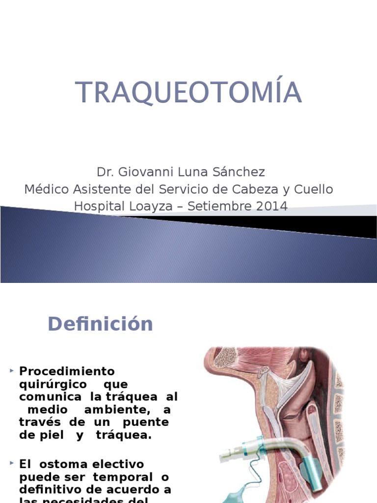 Traqueotomia | Tos | Sistema respiratorio