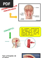 Escala RACE: Evaluación Prehospitalaria del Ictus | PDF | Cuidado de la ...