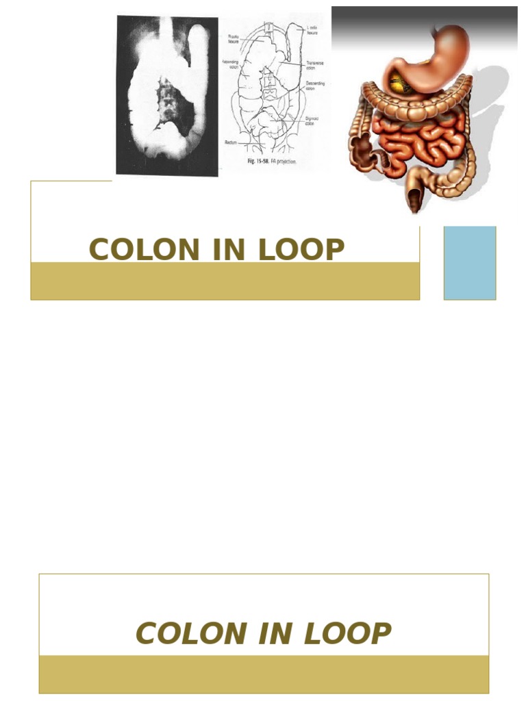 Radiologi Colon in Loop | PDF