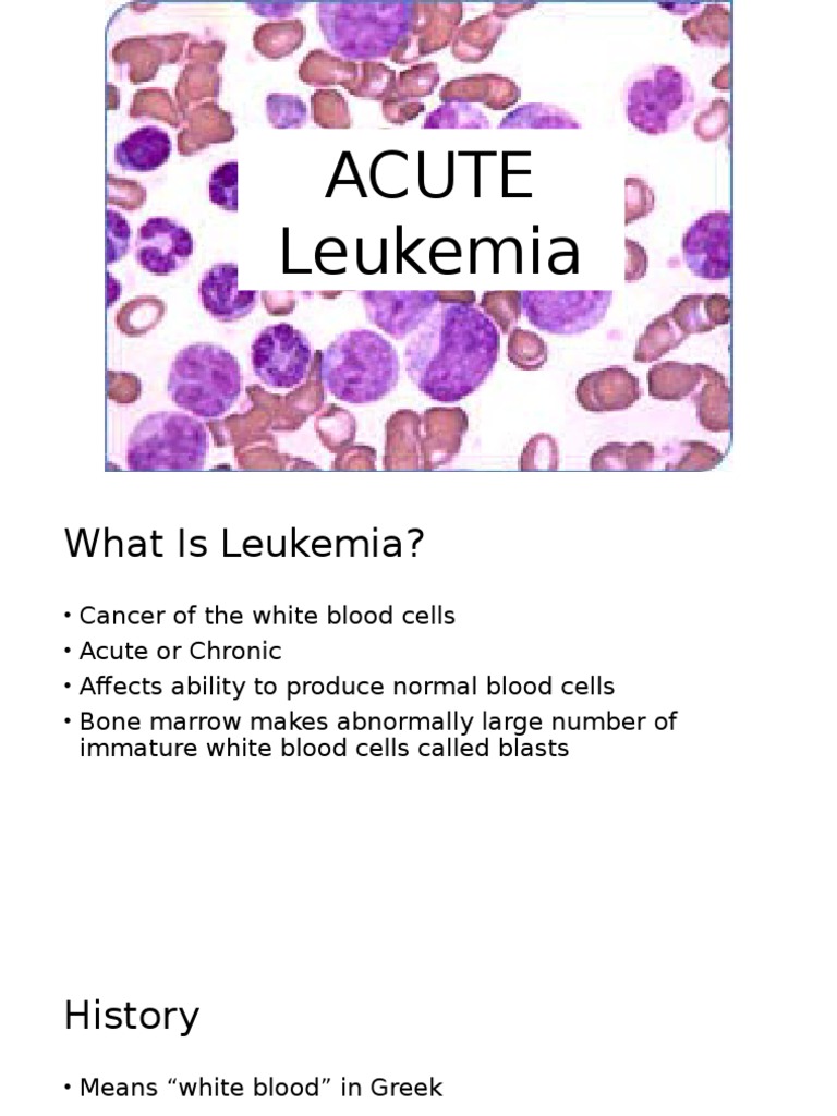 ACUTE Lymphocytic Leukemia | PDF