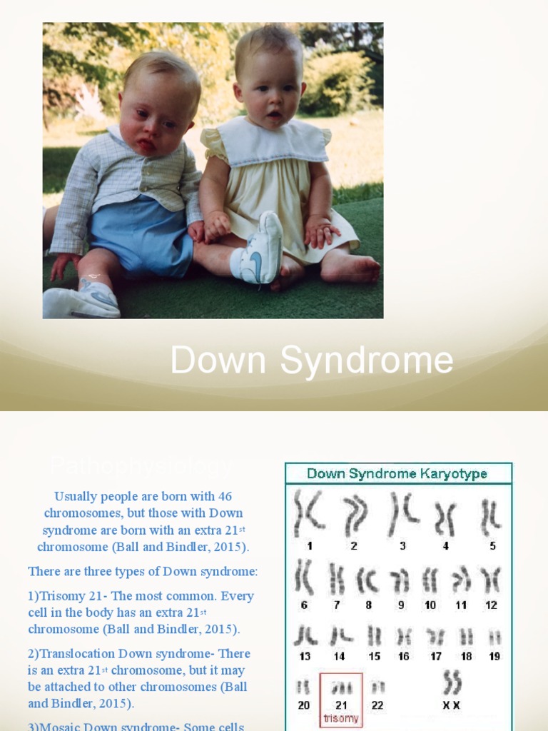 Down Syndrome Powerpoint-A Cornelius | PDF | Down Syndrome | Health Care