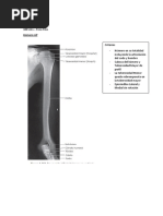 ANEXO TEMA 3 RODILLA-Fosa Intercondilea | PDF | Rodilla | Pelvis
