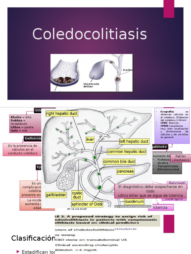 Coledocolitiasis | PDF