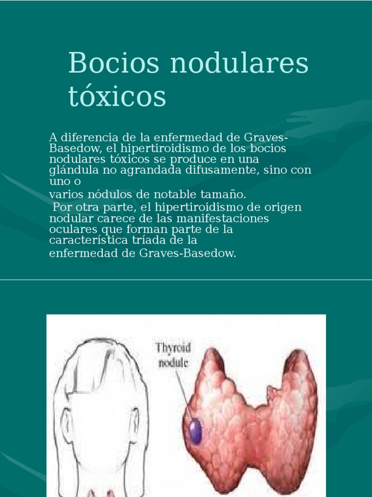 Bocios Nodulares Tóxicos | PDF | Hipertiroidismo | Tiroides