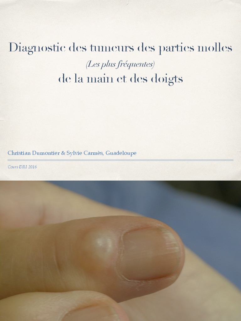 Diagnostic des kystes mucoïdes | PDF | Bien-être | Médical