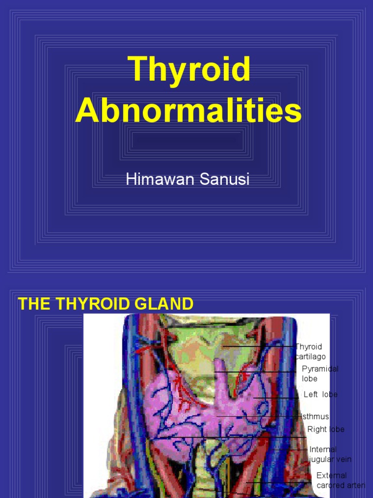 Nodul Tiroid Tiroiditis CA Tiroid-2 | PDF | Thyroid | Hypothyroidism