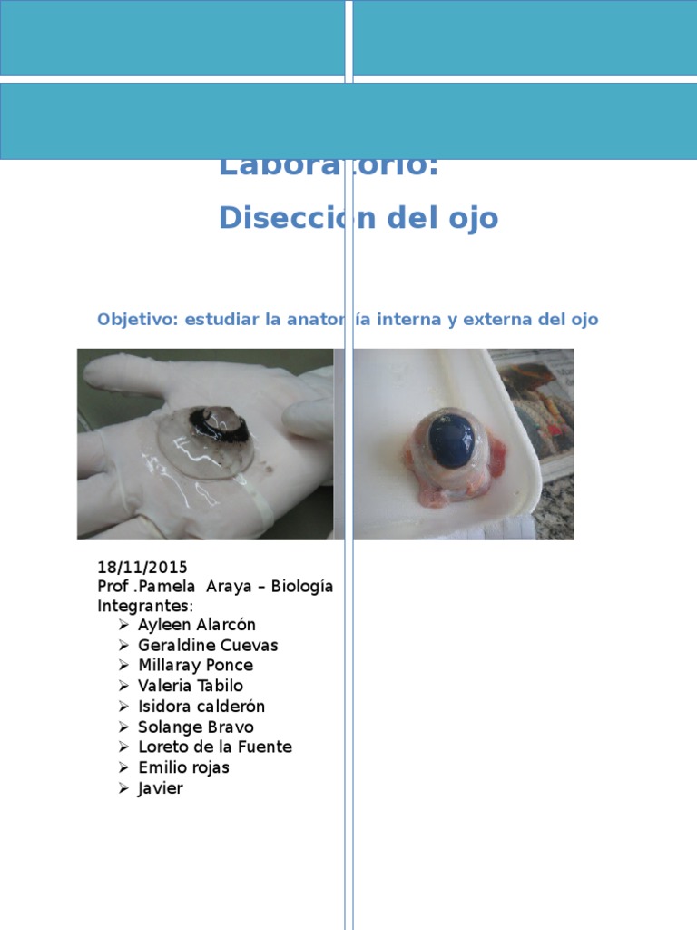 Informe Ojo Vaca | PDF | Ojo humano | Ojo