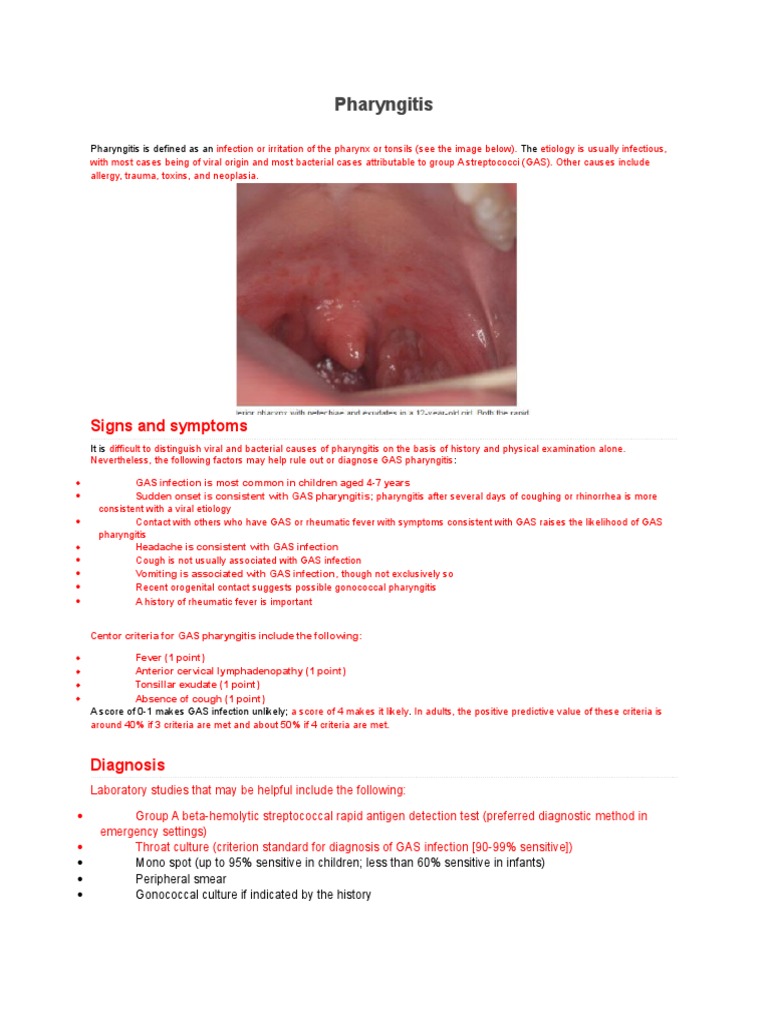 Pharyngitis | Streptococcus | Infection
