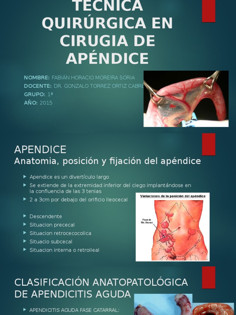 Técnica Quirúrgica en Cirugia de Apéndice