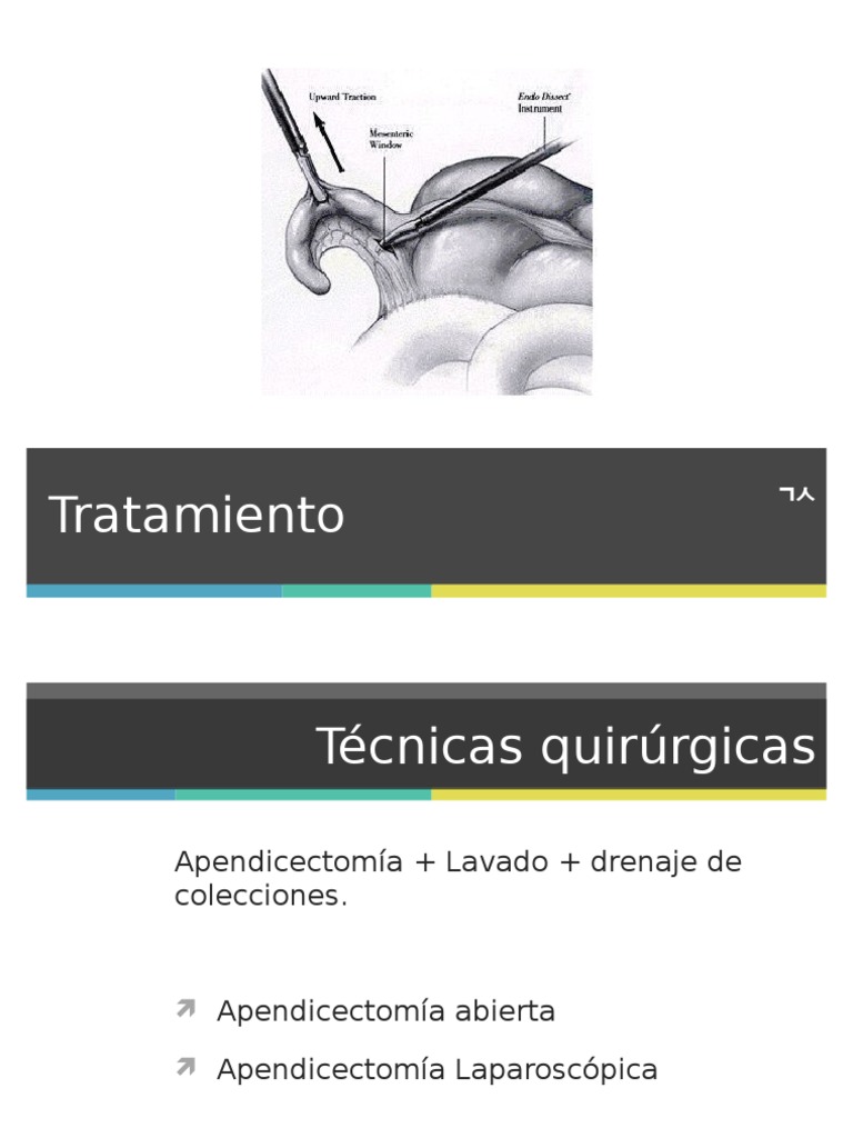 Técnicas Quirúrgicas Apendicitis Aguda