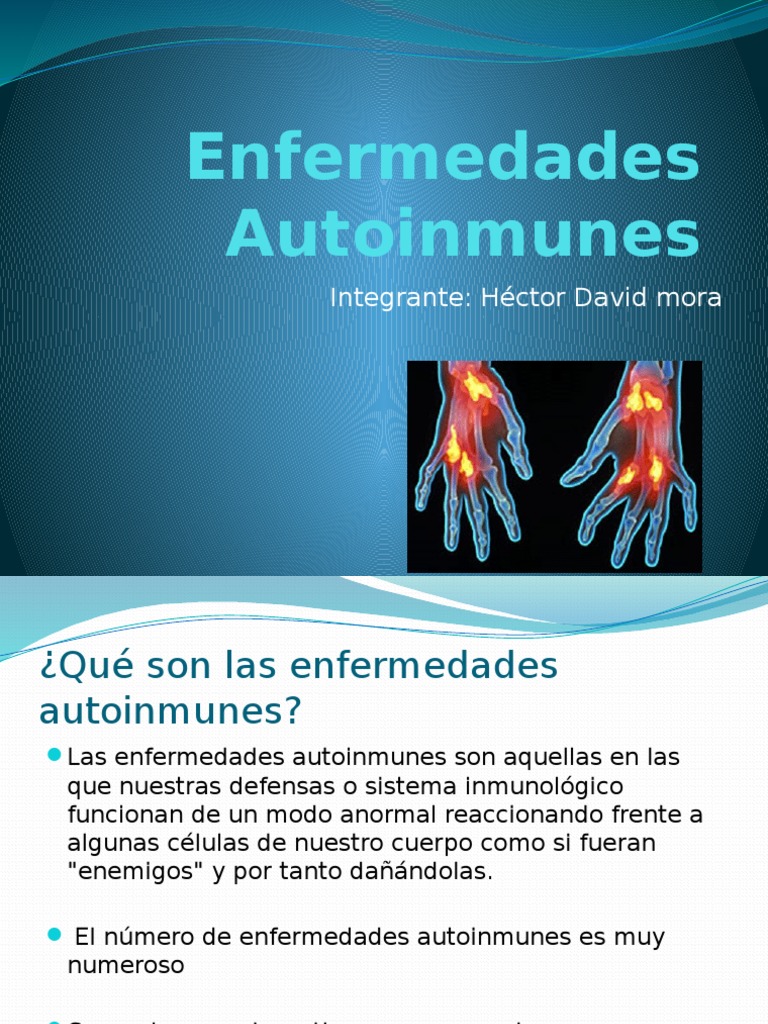 enfermedades autoinmunes | Esclerosis múltiple | Enfermedad autoinmune