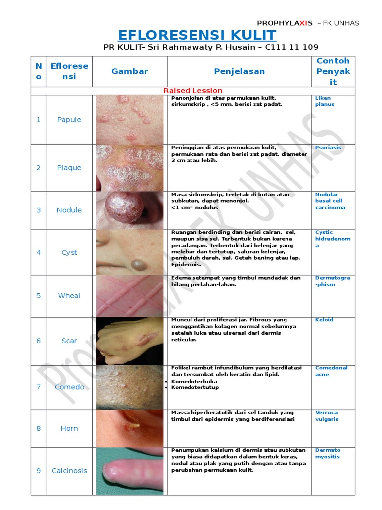 EFLORESENSI KULIT Fitzpatrick Disertai Gambar (Yayu)