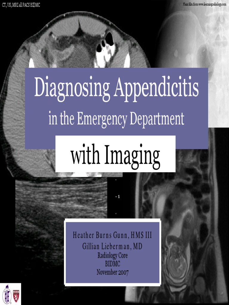 Imaging Appendicitis | Ct Scan | Radiology | Free 30-day Trial | Scribd