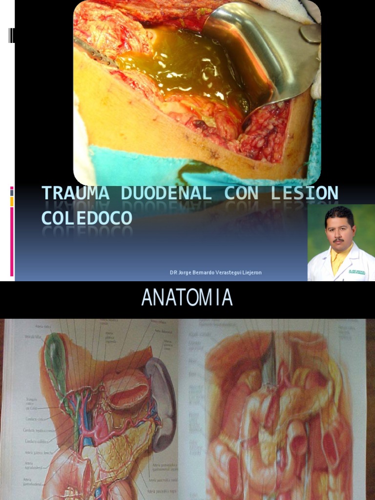 Trauma Duodenal Con Lesion Coledoco D | PDF | Lesión | Páncreas