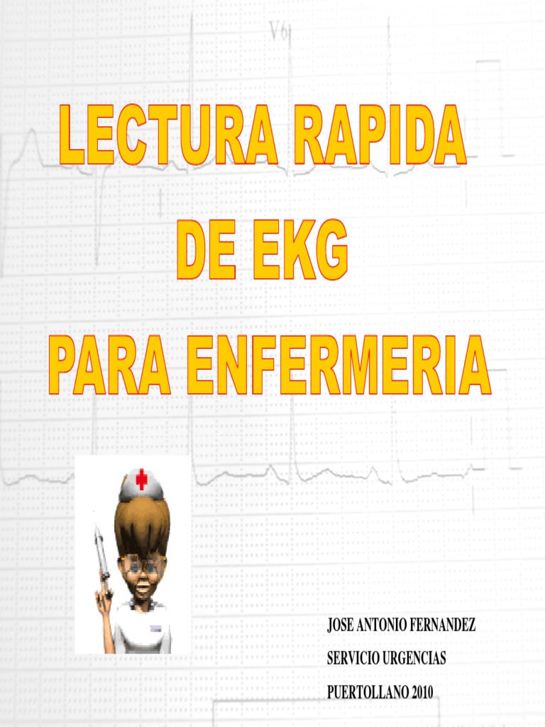 Lectura Rapida Ekg PDF | PDF