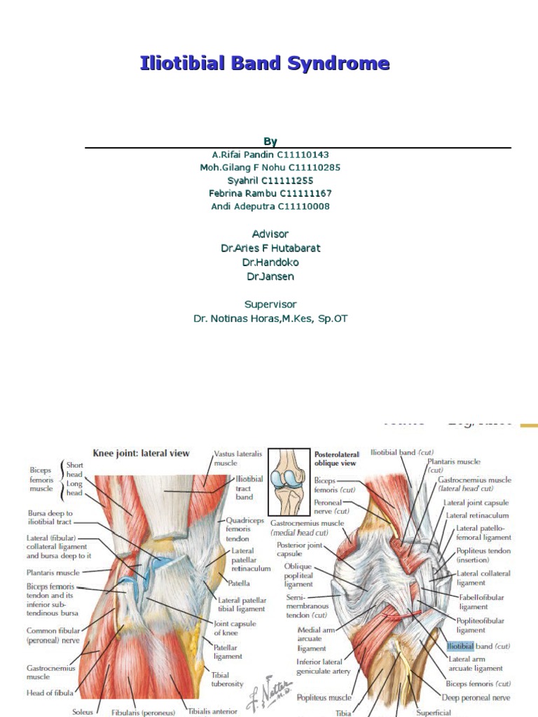 Tibial Band Syndrome | PDF | Science & Mathematics