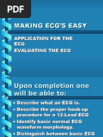 PAC.PJC.PVC | Cardiac Electrophysiology | Cardiac Arrhythmia | Free 30 ...