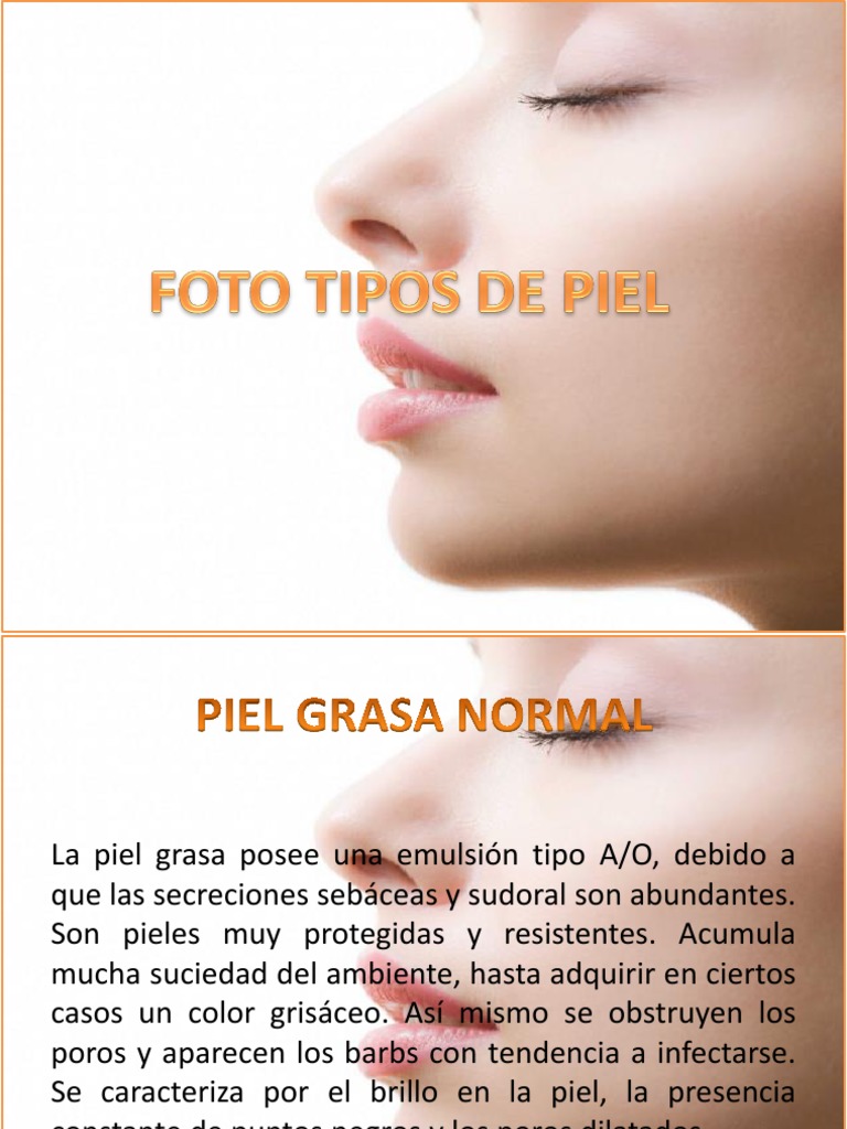 Tipos de Piel - Grasa Normal, Grasa Deshidratada, Ocluida y Mixta ...