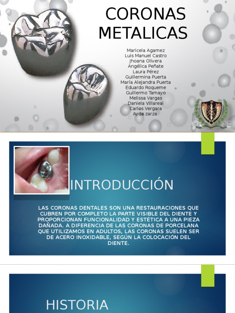 Nomenclatura y Tipos de Coronas Metálicas | PDF | Diente humano ...