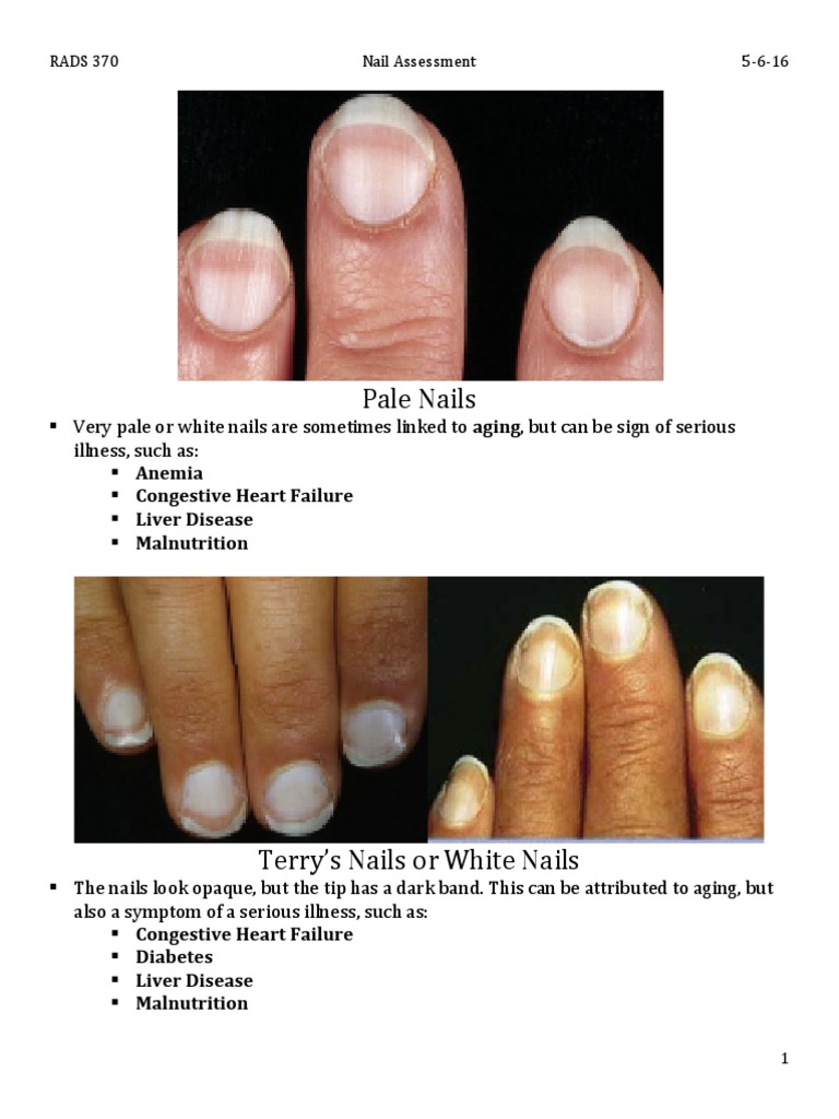 Nail Assessment | PDF | Nail (Anatomy) | Rtt