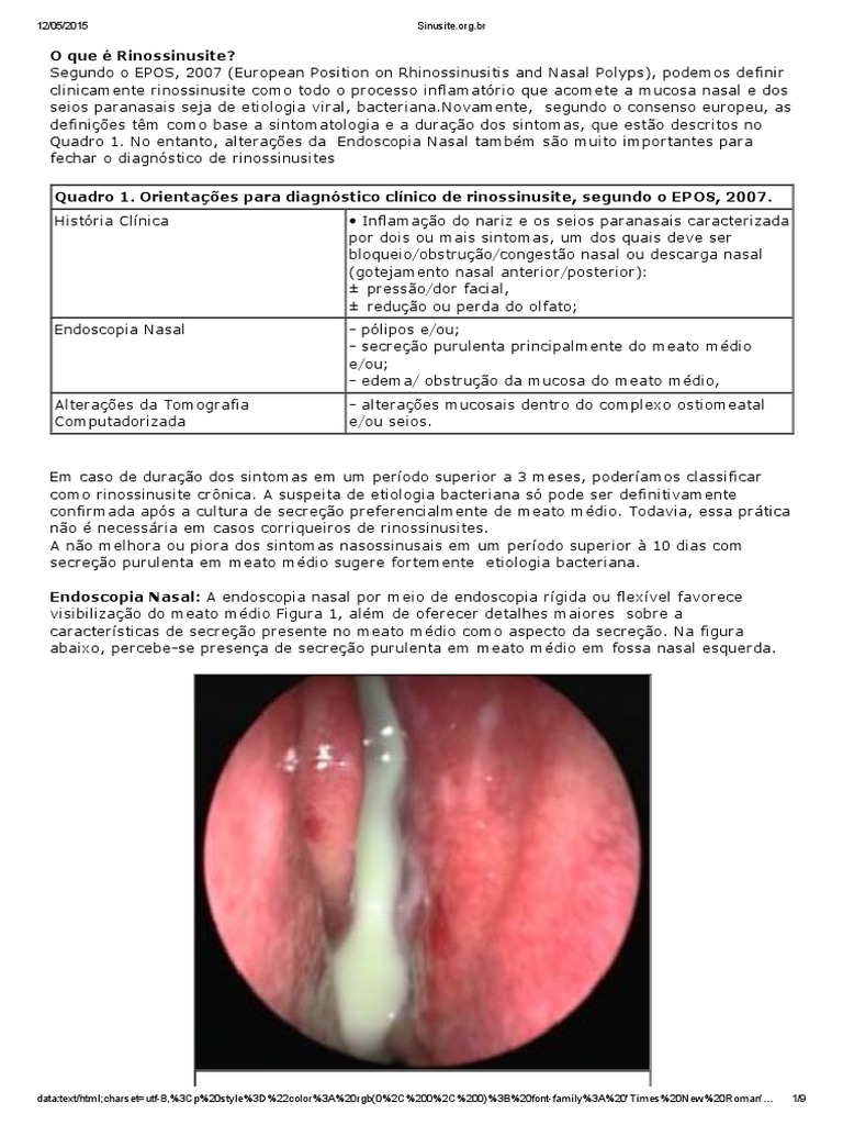 Sinusite | PDF | RTT | Especialidades médicas
