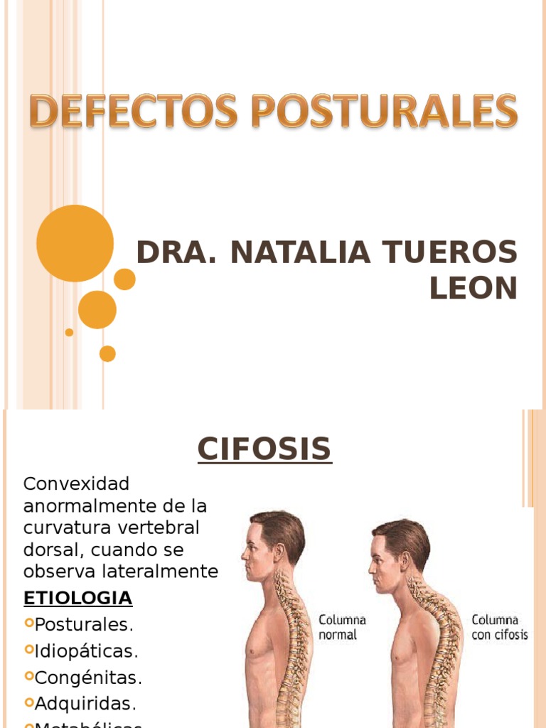 Defectos Posturales | PDF | Pie | Escoliosis