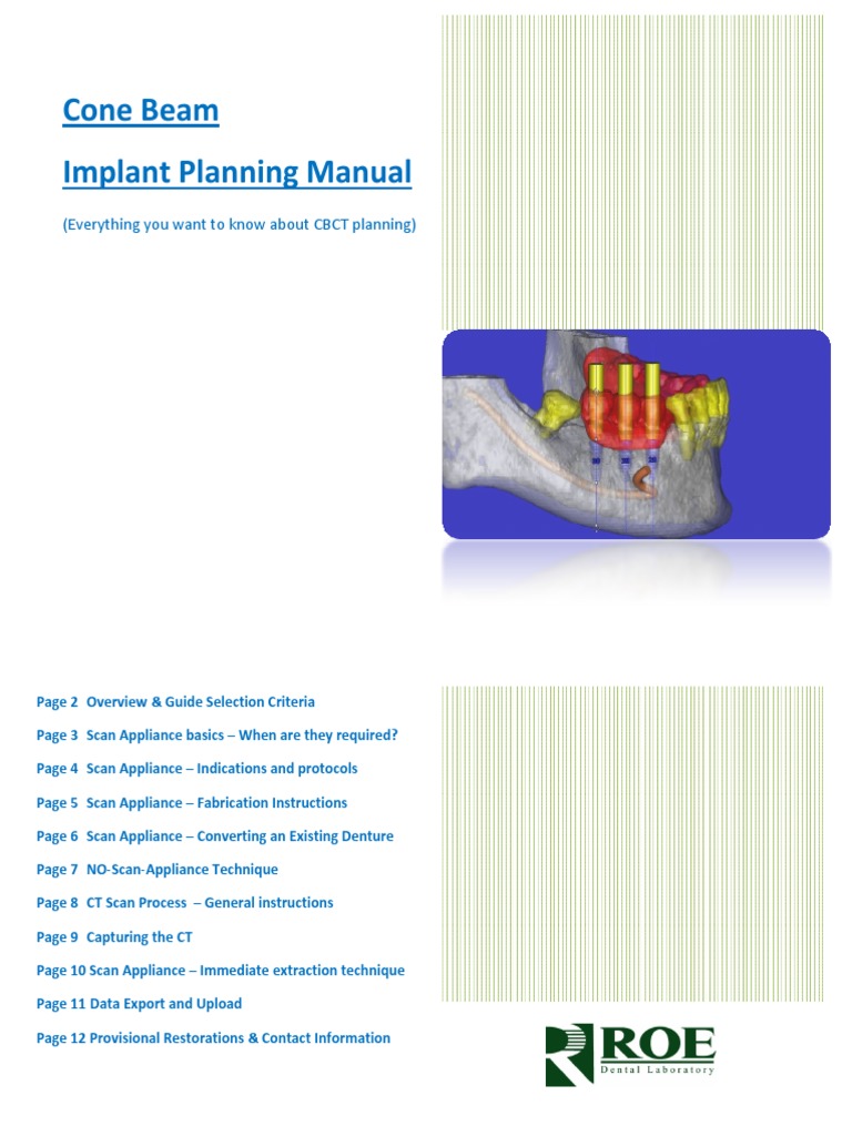 CT Scan Protocol | PDF | Dental Implant | Dentures