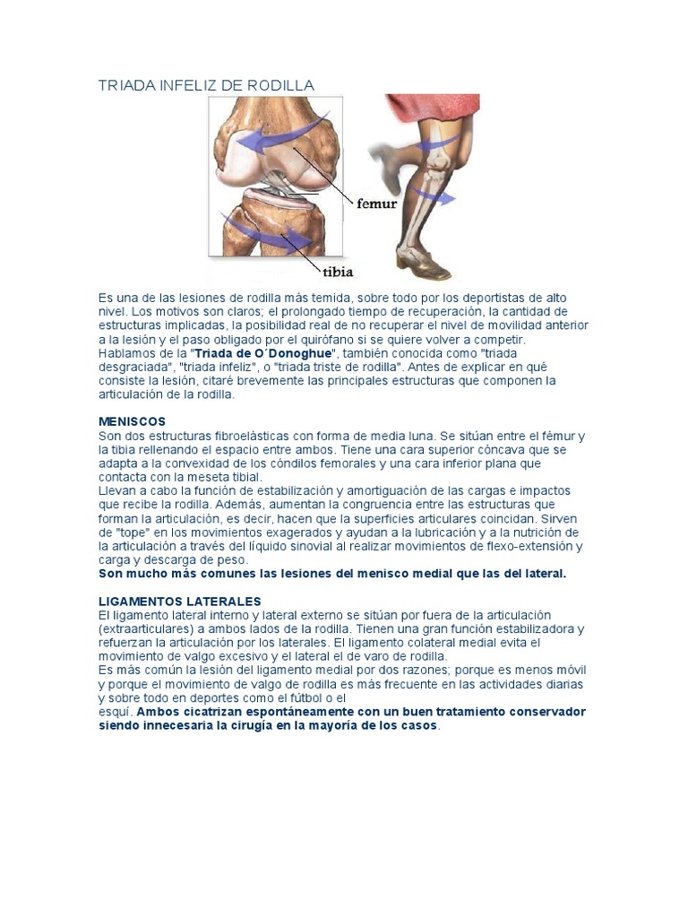 Triada Infeliz de Rodilla