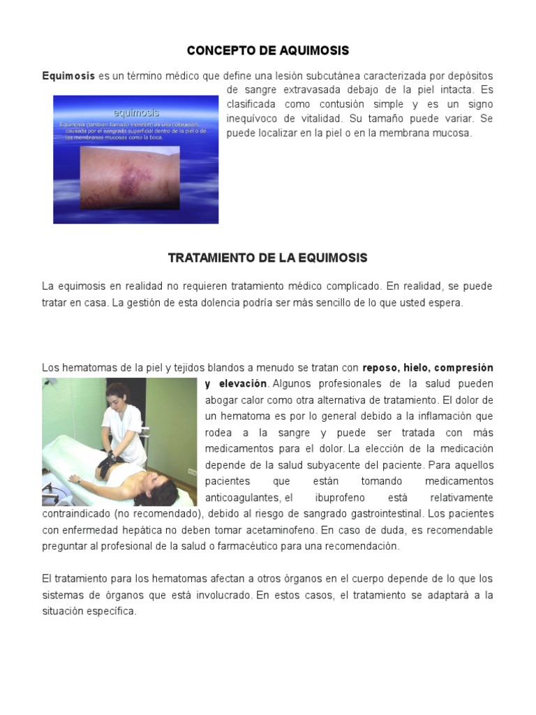 EQUIMOSIS | PDF | Hueso | Medicamentos con receta