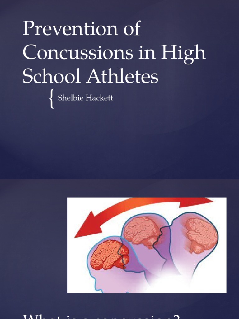 Concussion Prevention in High School Sports | PDF