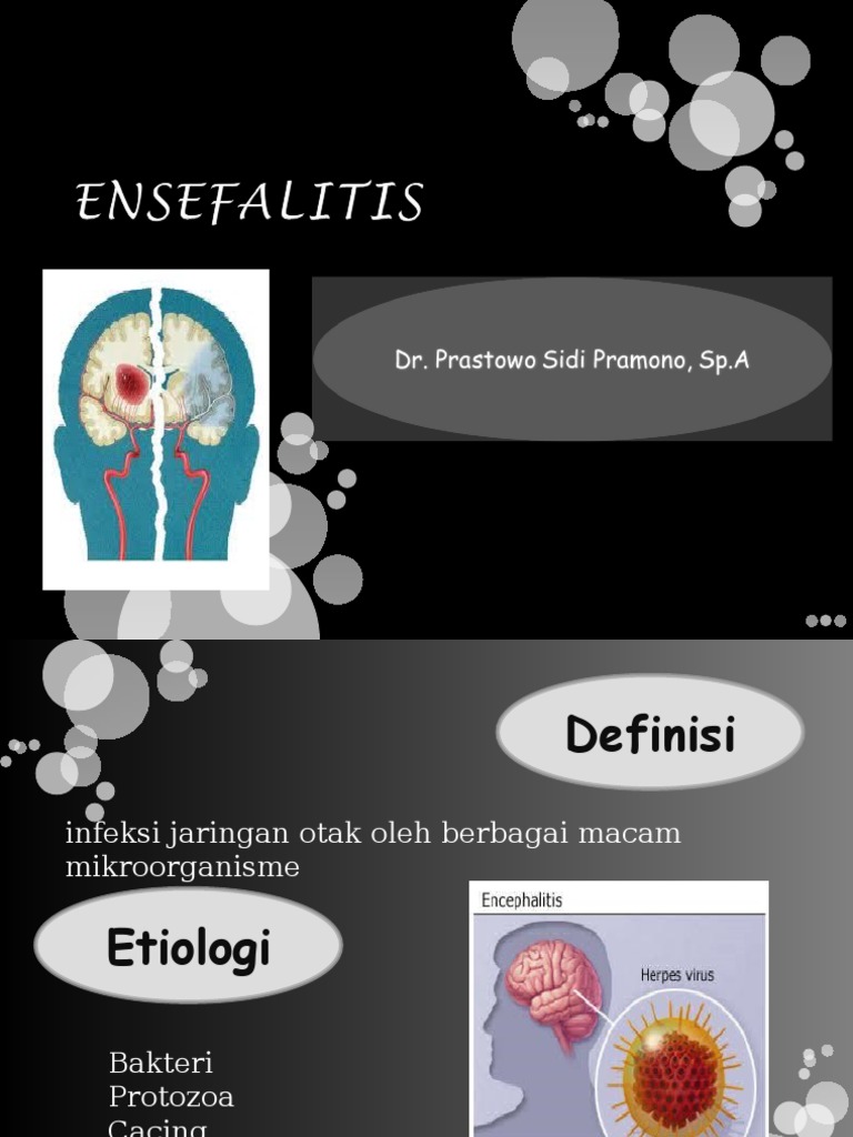 Ensefalitis PPT | PDF