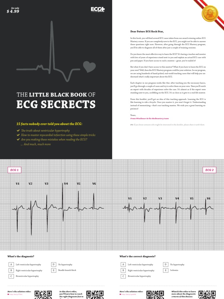The Little Black Book of Ecg Secrets PDF | PDF | Electrocardiography ...