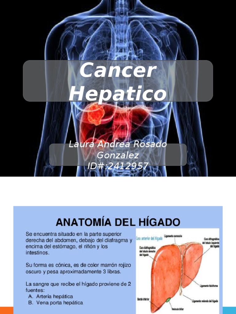 Cancer Hepatico | Cirrosis | Hígado